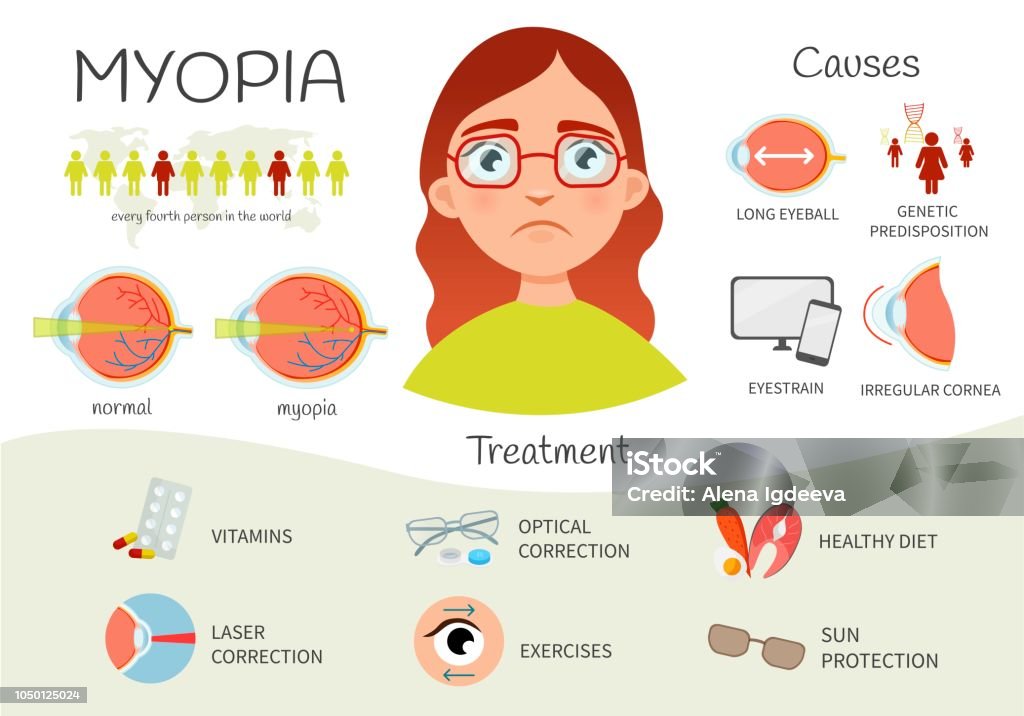 Ilustración De Infografías De La Miopía Y Más Vectores Libres De
