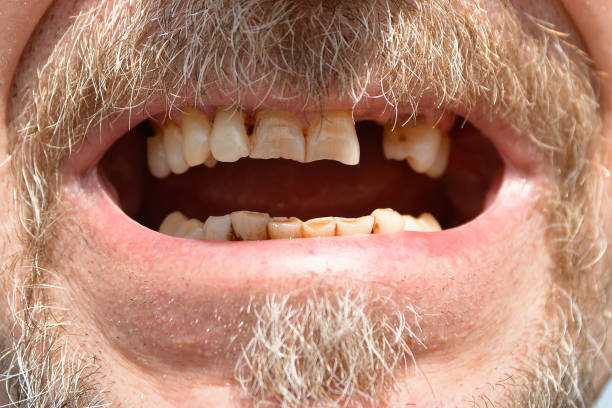 Bad Teeth Pictures | Download Free Images on Unsplash