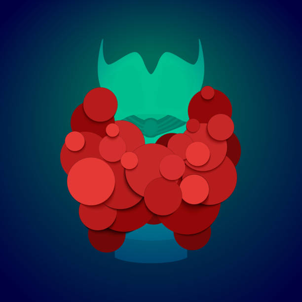 140 Thyroid Exam Ilustrasi Grafik Vektor And Clip Art Bebas Royalti