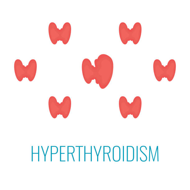 140 Thyroid Exam Ilustrasi Grafik Vektor And Clip Art Bebas Royalti