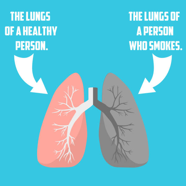 120+ Alveoli Damage Stock Illustrations, Royalty-Free Vector Graphics ... 120+ Alveoli Damage Stock Illustrations, Royalty-Free Vector Graphics ...