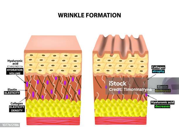 Munculnya Keriput Struktur Anatomi Kulit Elastin Asam Hyaluronic