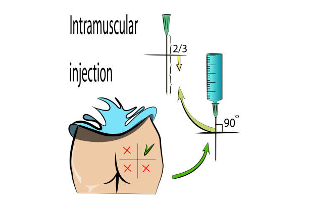 Intramuscular injection deltoid muscle Clipart Vector PNG , SVG, EPS ...