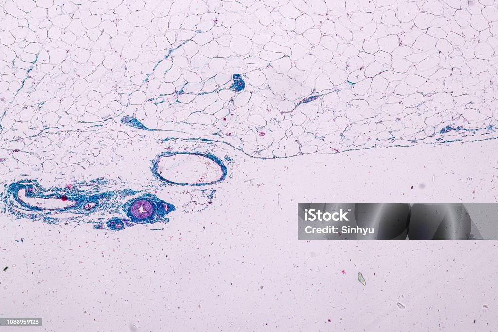 Adipose Tissuebody Fatsimply Fat Is A Loose Connective Tissue Under The Microscopic For
