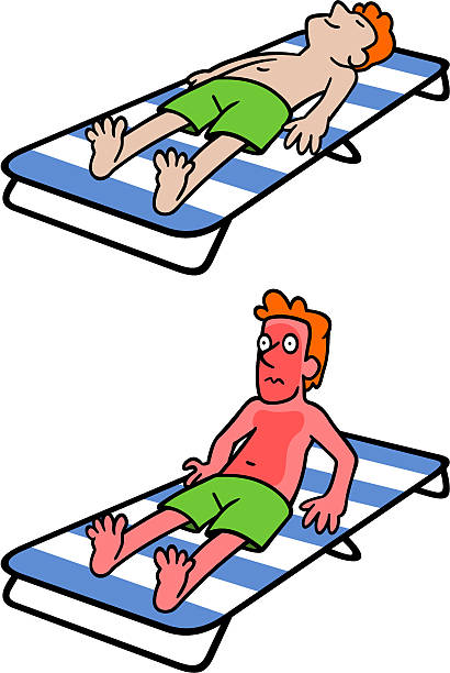 1 700 Cartoon Of Sunburn Stock Illustrations Royalty Free Vector