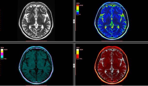 Brain Mri Pictures | Download Free Images on Unsplash