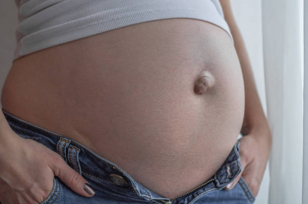 330 Hernia Umbilical Fotografías De Stock Fotos E Imágenes Libres De