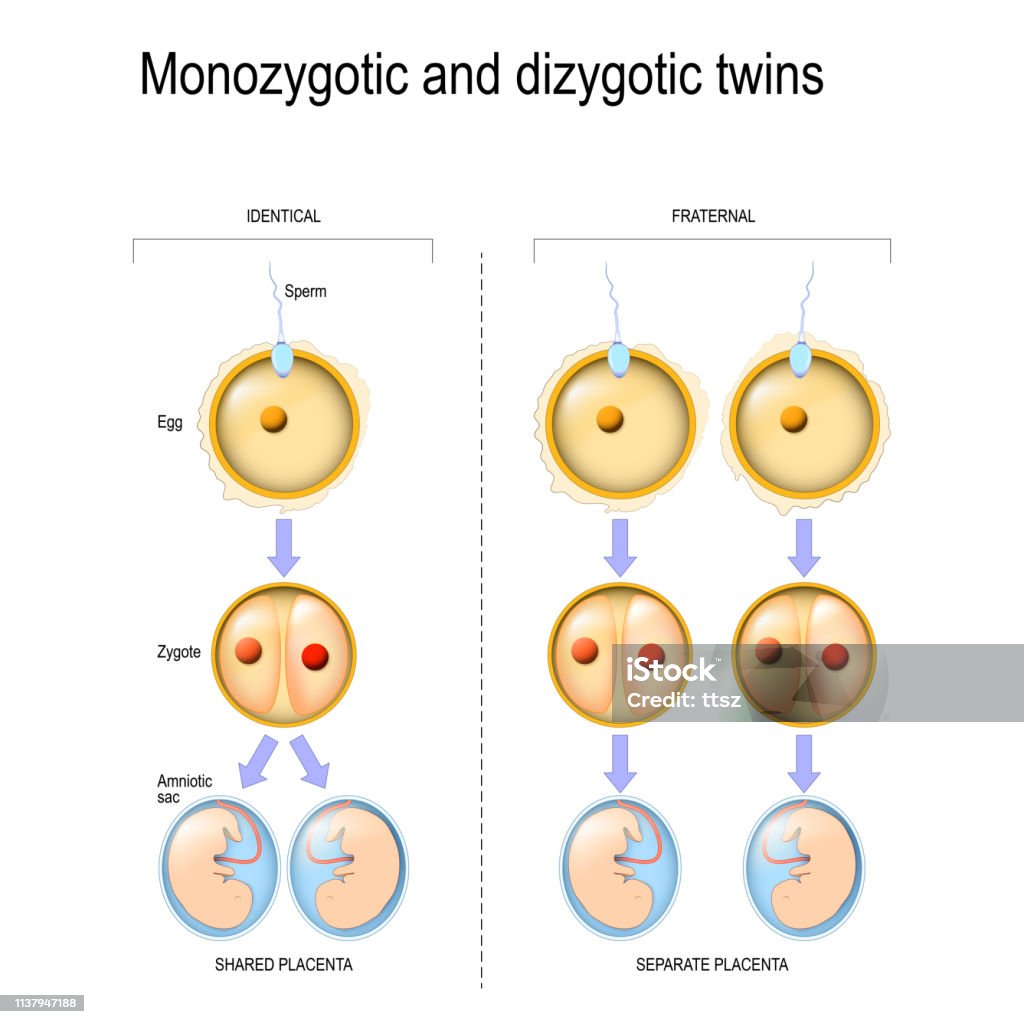 Perbedaan Dan Perbandingan Perkembangan Zygote Pada Kembar Monozigotik ... Perbedaan Dan Perbandingan Perkembangan Zygote Pada Kembar Monozigotik ...