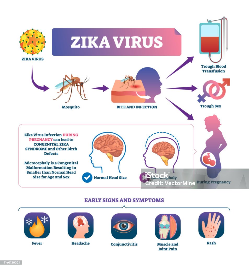 Ilustrasi Vektor Virus Zika Skema Tanda Infeksi Gigitan Nyamuk Berlabel ... Ilustrasi Vektor Virus Zika Skema Tanda Infeksi Gigitan Nyamuk Berlabel ...
