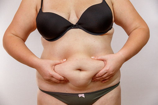Woman Squeezes Her Stomach Girl Squeezes Fat On Her Stomach Fatty Folds On The Abdomen Stock