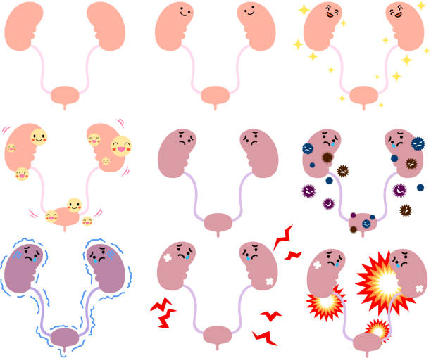 50 Sindrom Nefrotik Ilustrasi Grafik Vektor And Clip Art Bebas Royalti