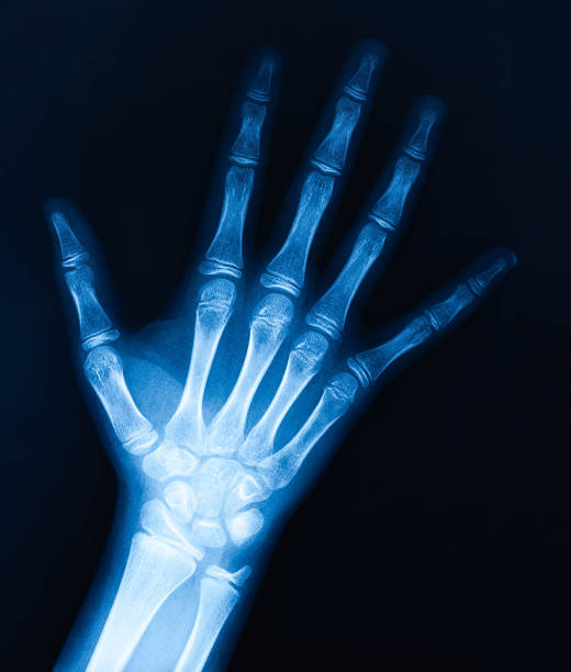 Skeleton Hand Pictures | Download Free Images on Unsplash