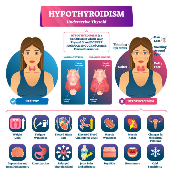 Hyperthyroidism Vs Hypothyroidism