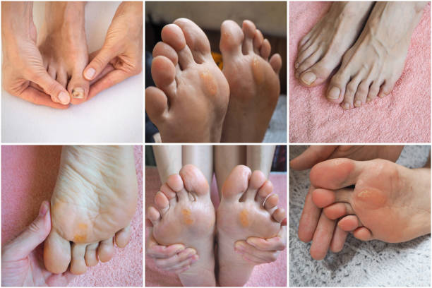 Free picture: Photo collage of many bare feet