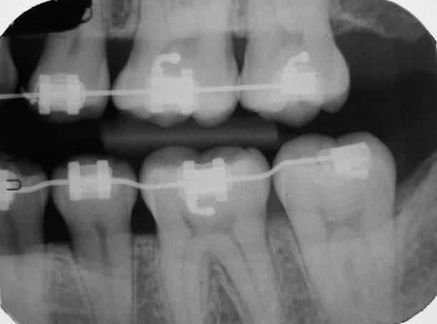 Bitewing X Rays Pictures | Download Free Images on Unsplash