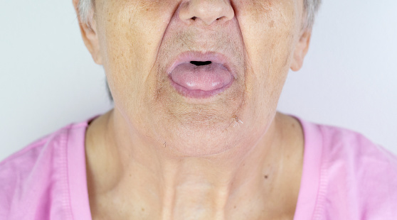Boca Sin Dientes Una Anciana Sin Dientes Vieja Abuela Con La Boca