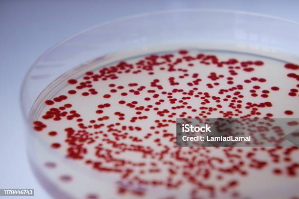 Colonies Of Prodigiosin Producing Bacterium Serratia Marcescens Spread
