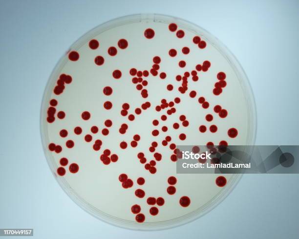 Colonies Of Prodigiosin Producing Bacterium Serratia Marcescens Spread