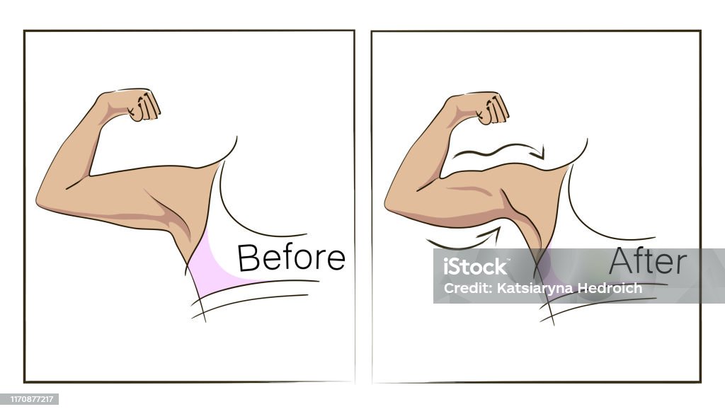 Female Biceps And Triceps Before And After Sport Arms Showing Progress