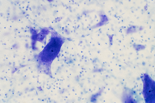 Neuron Dan Sistem Saraf Di Otak Manusia Histologi Jaringan Otak Manusia Foto Di Bawah Tampilan