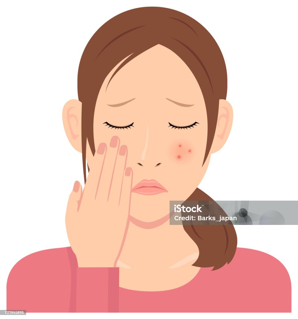 Young Woman Vector Illustration Acne Pimple Treckles Rash Stock