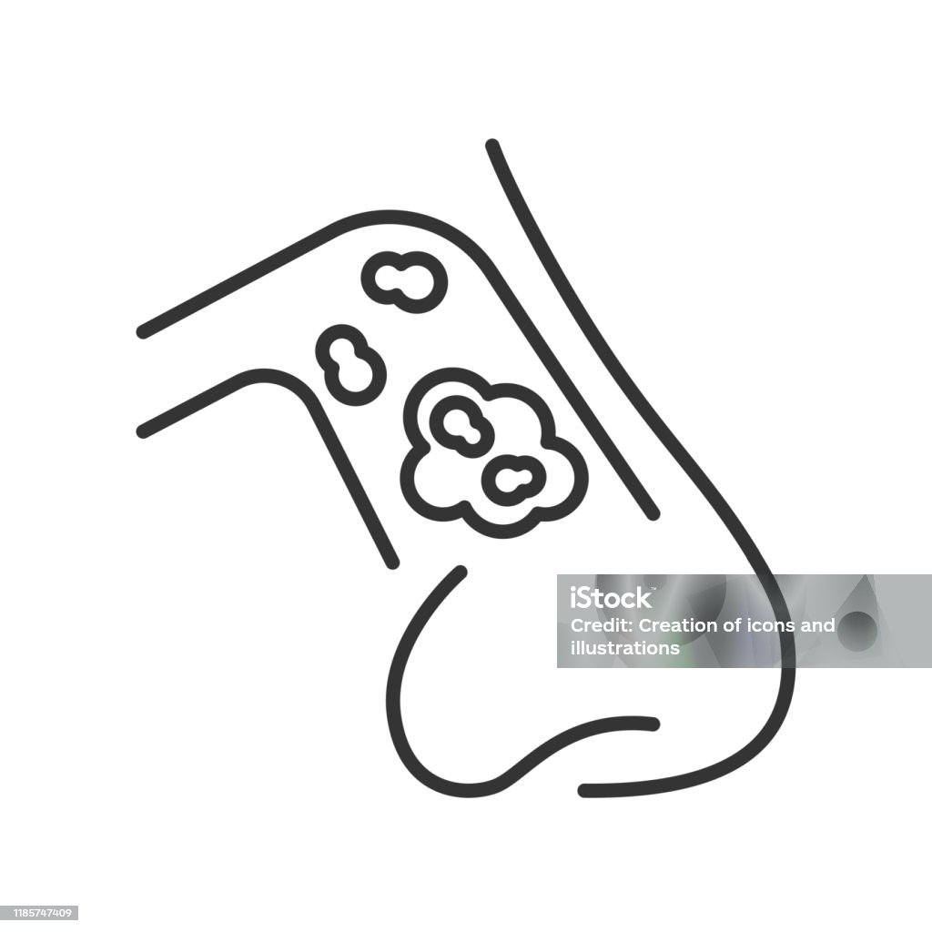 Nose Cancer Line Black Icon Human Organ Concept Malignant Neoplasm Respiratory Diseases Stock