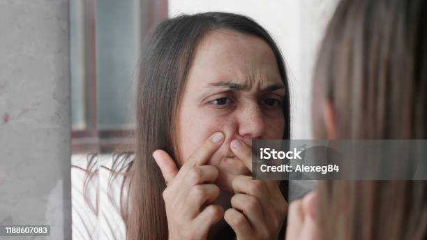 Young Woman Is Looking On Her Pimples In Face Skin In Mirror Stock