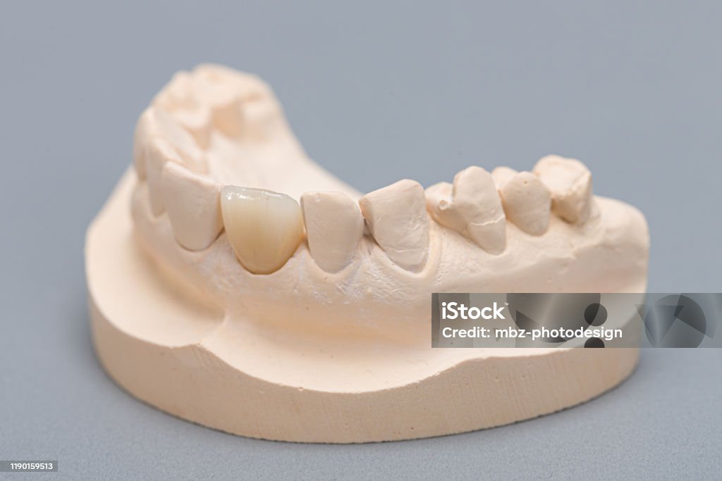 Close Up Of Dental Imprint With Artificial Canine Teeth In Dental ... Close Up Of Dental Imprint With Artificial Canine Teeth In Dental ...