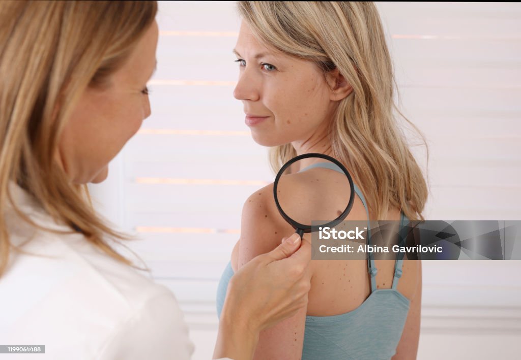 Doctor Dermatologist Examines Birthmark Of Patient Checking Benign