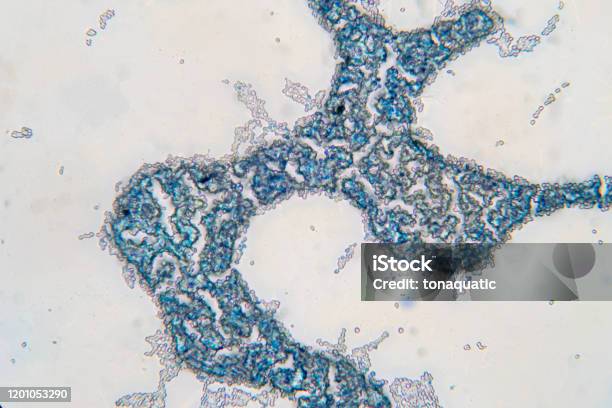 Saccharomyces Cerevisiae Ragi Tunas Sel Di Bawah Mikroskop Foto Stok