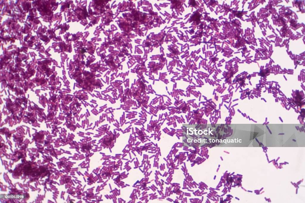 Bacillus Gram Positive Stain Under The Microscope View Bacillus Is