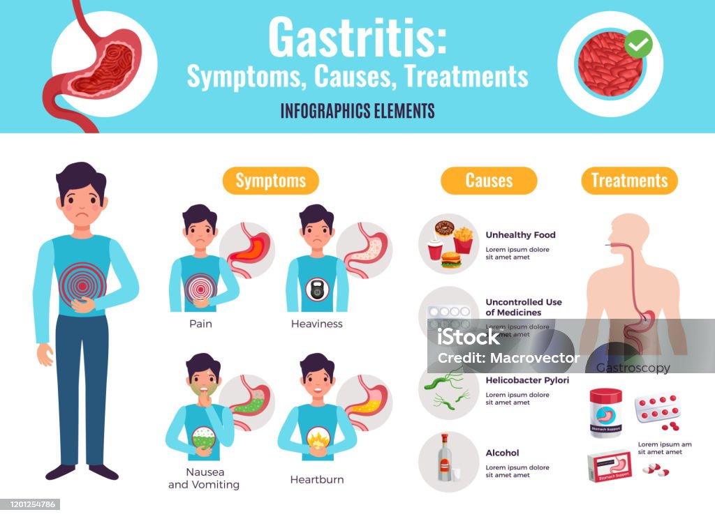 Infografis Gastritis Ilustrasi Stok - Unduh Gambar Sekarang - Penyakit ... Infografis Gastritis Ilustrasi Stok - Unduh Gambar Sekarang - Penyakit ...