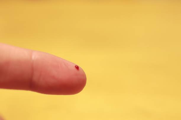 30,000+ Blood Finger Pictures | Download Free Images on Unsplash