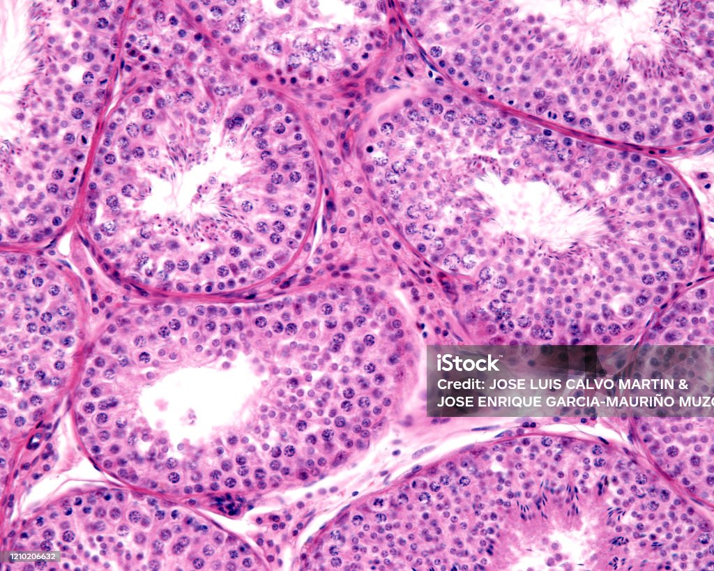Seminiferous Tubules Histology Labeled