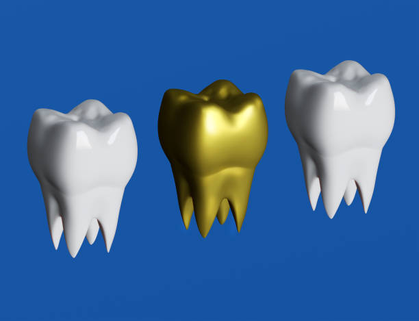 Gold Teeth Pictures | Download Free Images on Unsplash