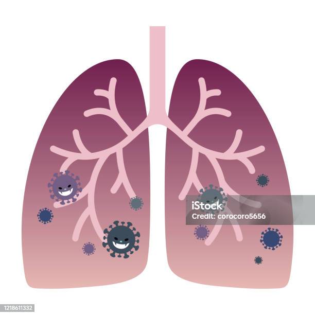 Paruparu Dan Virus Pneumonia Ilustrasi Stok Unduh Gambar Sekarang