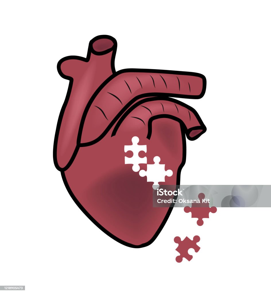 Human Heart Heart Diseases Vector Illustration Stock Illustration