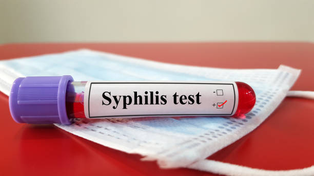 blood test for diagnosis syphilis infection (TPHA, VDRL) Blood | Care ...
