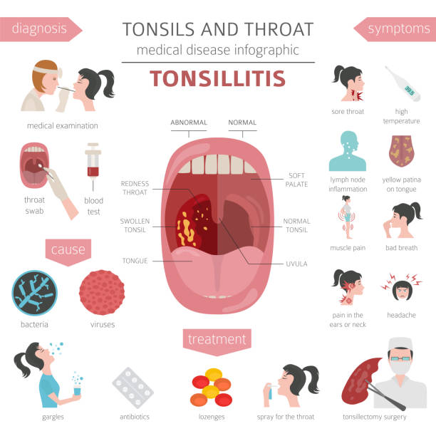 430+ Swollen Tongue Stock Photos, Pictures & Royalty-Free Images - iStock 430+ Swollen Tongue Stock Photos, Pictures & Royalty-Free Images - iStock