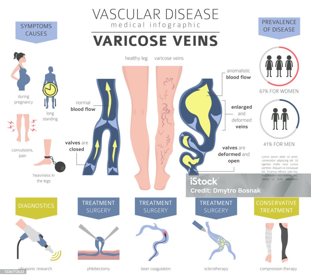 Vascular Diseases Varicose Veins Symptoms Treatment Icon Set Medical