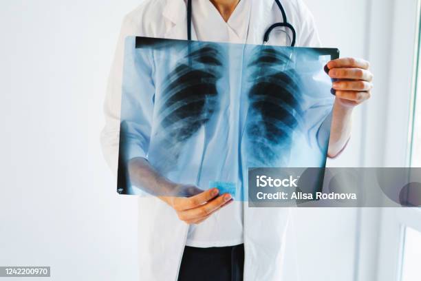 Dokter Memegang Xray Paruparunya Hari Dokter Internasional Dokter Di ... Dokter Memegang Xray Paruparunya Hari Dokter Internasional Dokter Di ...