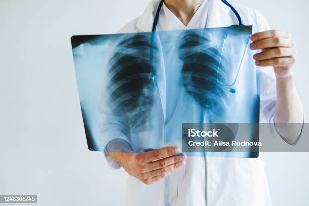 Dokter Memegang Xray Paruparunya Hari Dokter Internasional Dokter Di ... Dokter Memegang Xray Paruparunya Hari Dokter Internasional Dokter Di ...