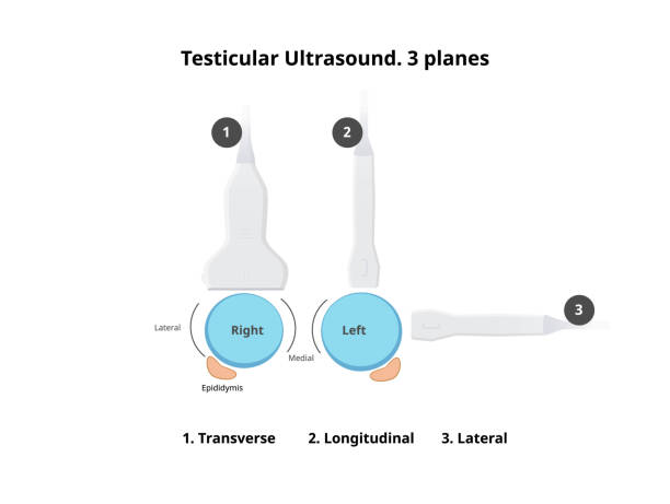 50 Anatomy Of Testis Drawing Stock Illustrations Royalty Free Vector
