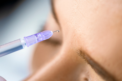 Photo Libre De Droit De Traitement De Lacide Hyaluronique Injection De