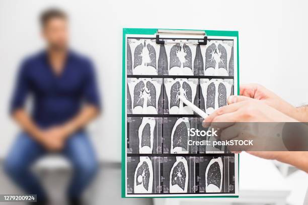 Ahli Paru Menunjukkan Ct Scan Pasien Paruparu Dengan Fibrosis Paru