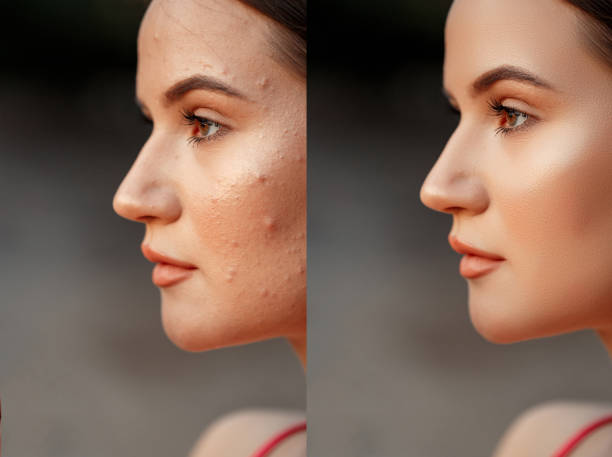 Skin Retouch Pictures | Download Free Images on Unsplash