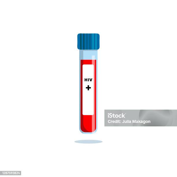 Tabung Uji Dengan Sampel Darah Tes Hiv Positif Pemeriksaan Medis Untuk