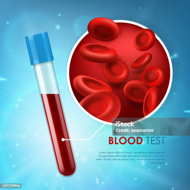Affiche De Médecine Vectorielle Danalyse De Sang Avec Le Globule Rouge