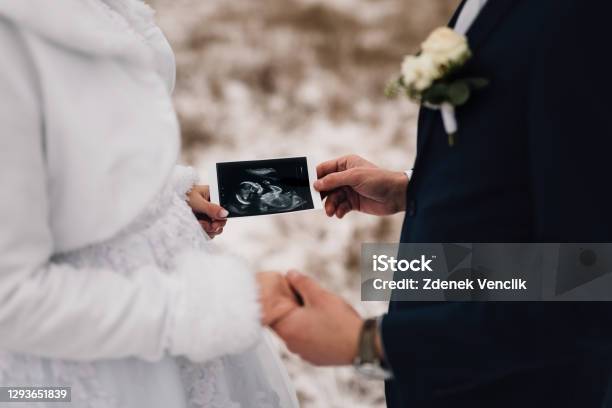 Pasangan Pernikahan Dengan Gambar Usg Di Tangan Mereka Foto Stok ... Pasangan Pernikahan Dengan Gambar Usg Di Tangan Mereka Foto Stok ...