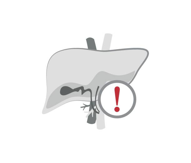 70 People With Cirrhosis Liver Clip Art Stock Illustrations Royalty